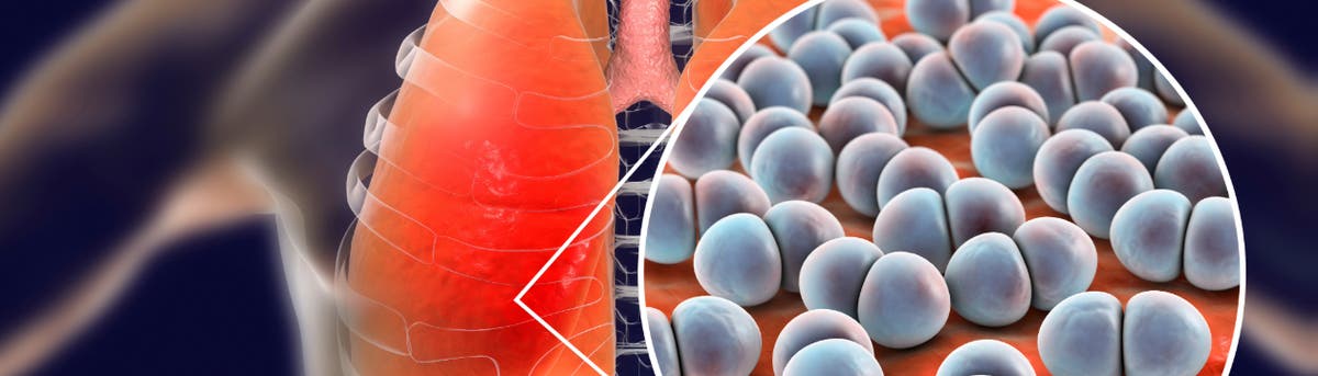 Pfizer Conmigo | Áreas Terapéuticas | Enfermedades Respiratorias ...